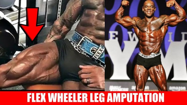 Flex Wheeler，緊急手術で右脚を切断